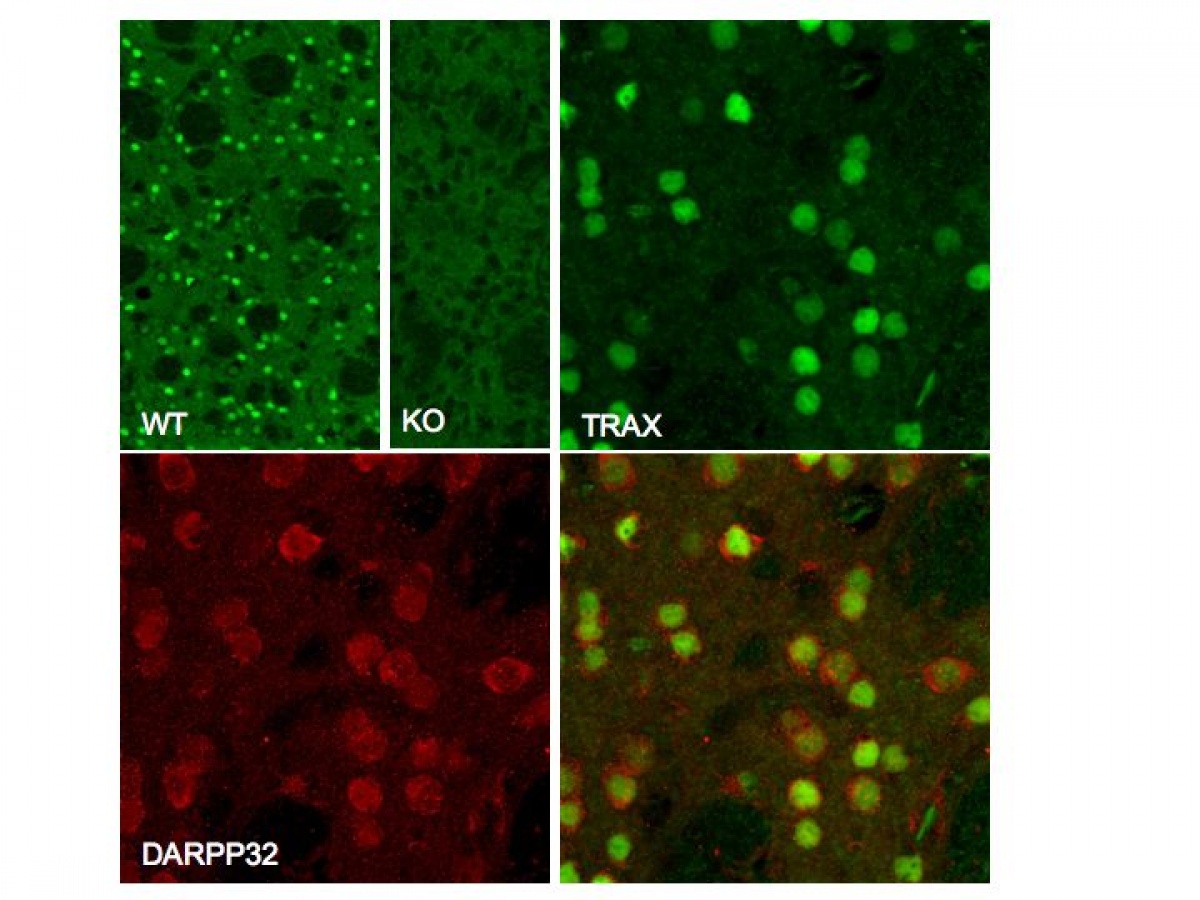 Jay Baraban - The Solomon H Snyder Department of Neuroscience