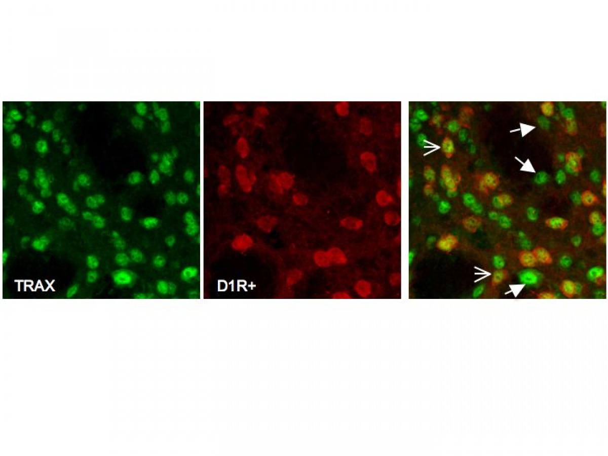 Jay Baraban - The Solomon H Snyder Department of Neuroscience