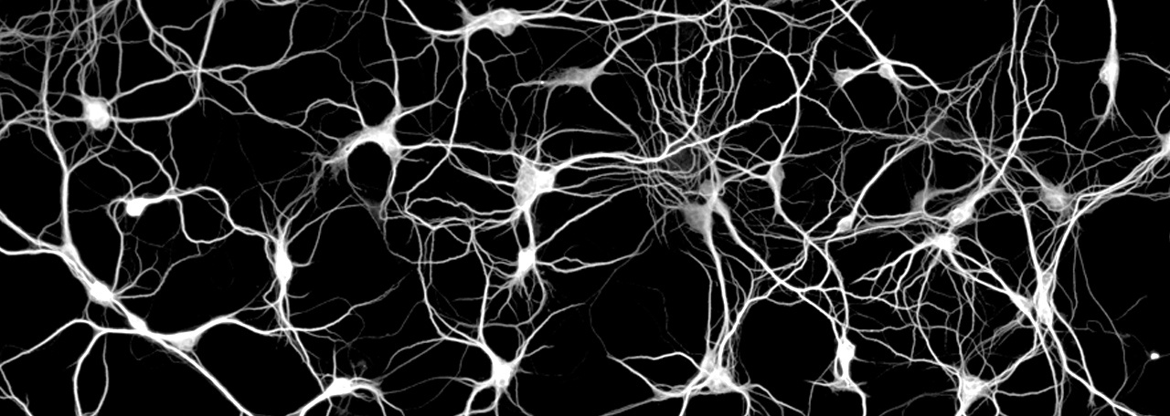 Areas of Research - The Solomon H Snyder Department of Neuroscience