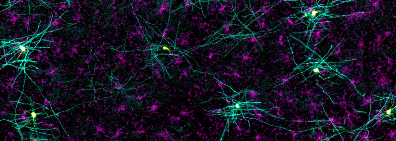 Neuroscience Imaging Center (NIC) - The Solomon H Snyder Department of ...
